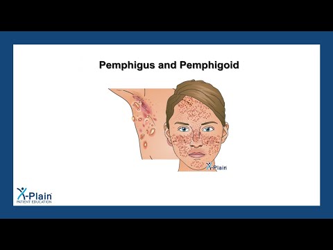 Pemphigus and Pemphigoid