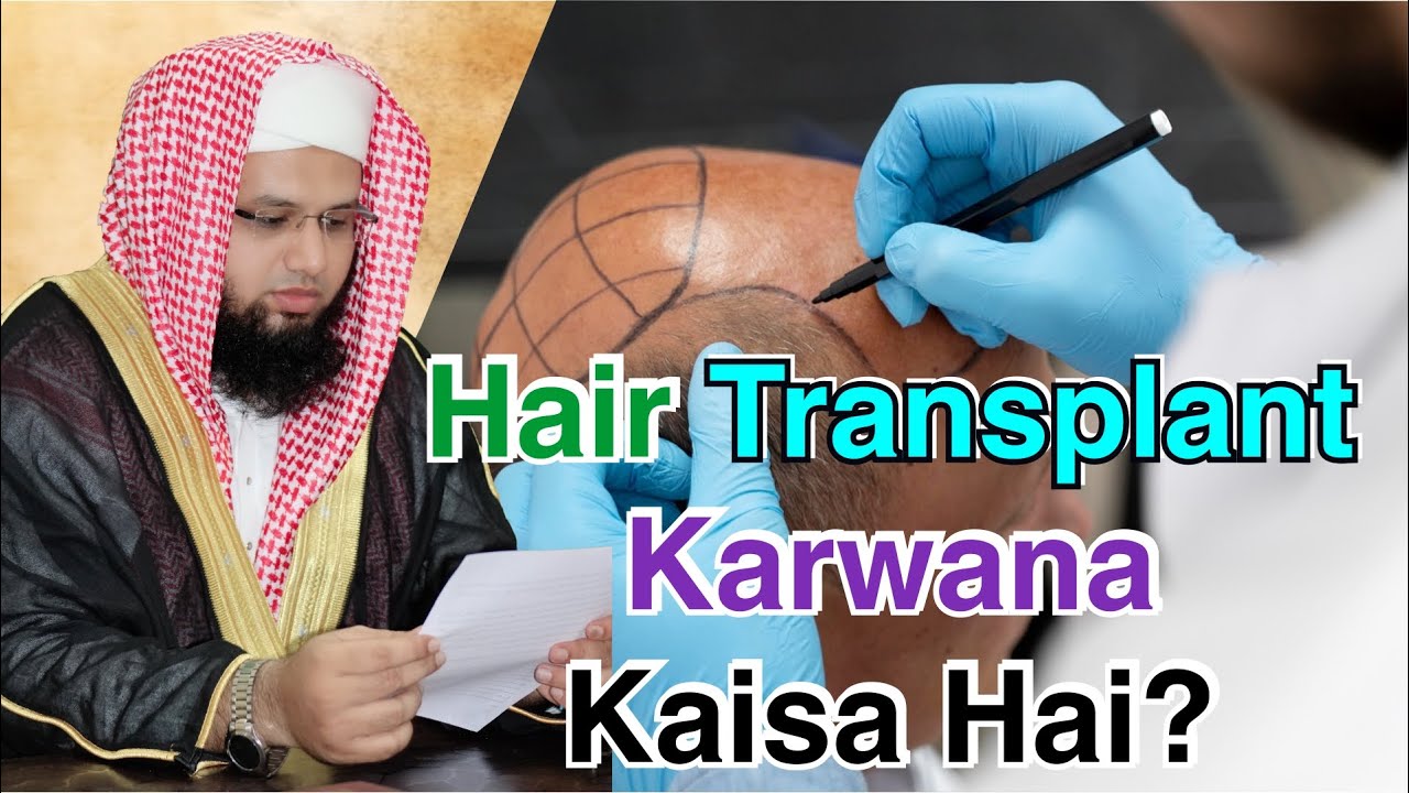 Hair Transplant Karwana Kaisa Hai? | Tooth Braces lagana? | Beauty ...