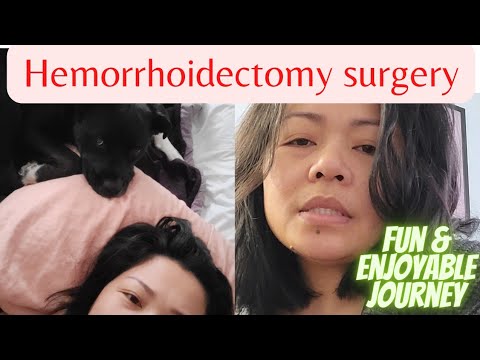 HEMORRHOIDECTOMY JOURNEY|15 days post op surgery|fun & enjoyable 😉 ...