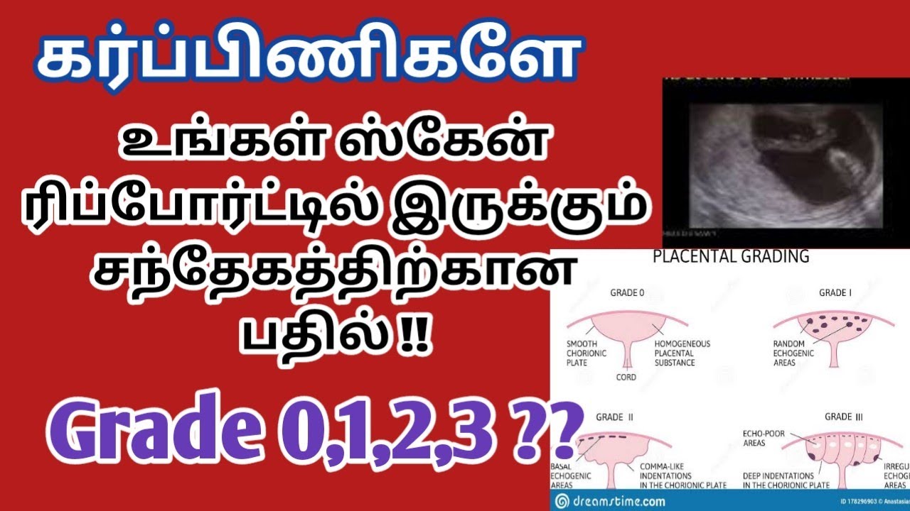 placental maturity grading in tamil | Grade 0 | Grade 1 | Grade 2 ...