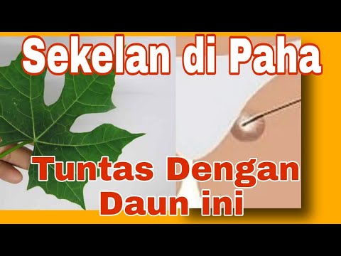 Penyebab sekelan