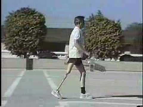 Excessive Heel Rise - YouTube