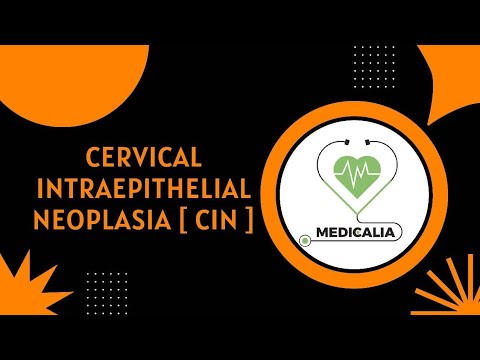 Cervical Intraepithelial Neoplasia CIN ( part 1 ) :{ Definition - Risk ...