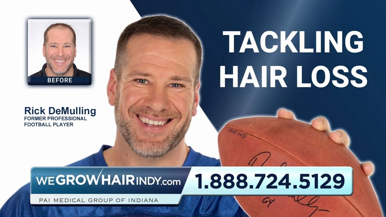 JMV & Rick DeMulling Are Tackling Hair Loss! - YouTube