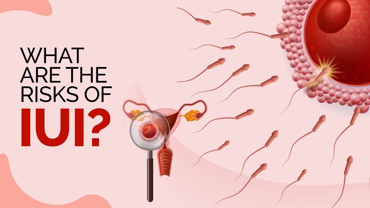 How does IUI work? What are the risks of IUI? - YouTube