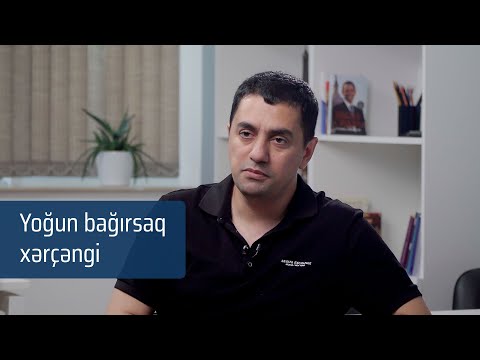 Yoğun bağırsaq xərçənginin əlamətləri və əməliyyatı #DrElgünSəmədov #YoğunBağırsaqXərçəngi