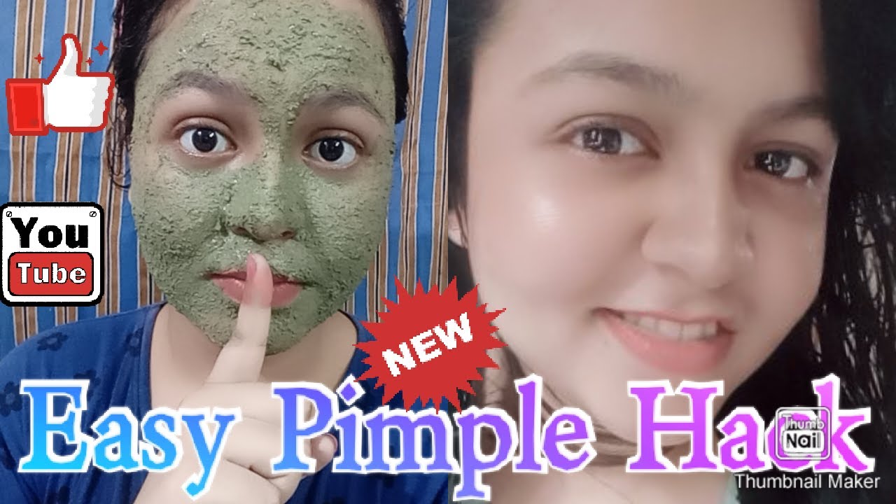 Easy Pimple hack...check it now and just just try it for better results ...