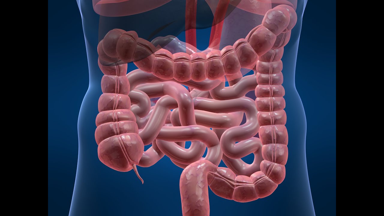 Como Hacer una Limpieza de Colon - YouTube