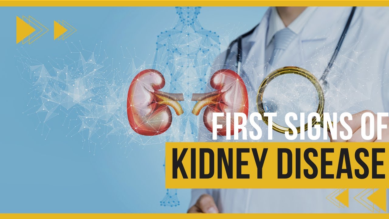 🔴KIDNEY DISEASE | First Sign of KIDNEY Disease. - YouTube