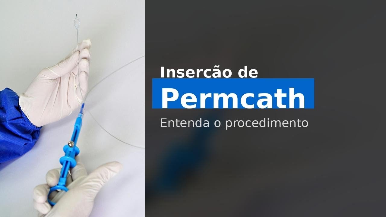 PERMCATH na prática: do preparo à inserção com segurança. - YouTube