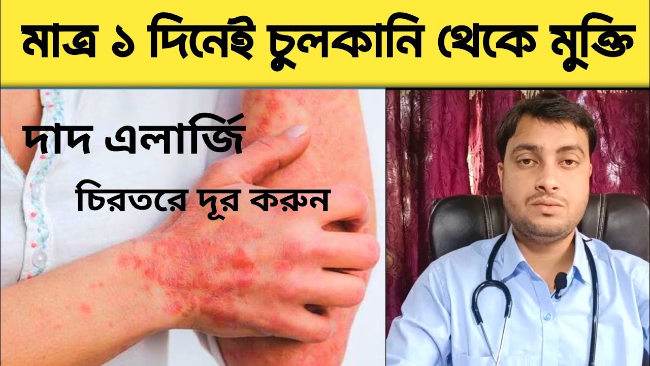 চুলকানির ওষুধ।। চুলকানির চিকিৎসা ।। চুলকানির হোমিও ওষুধ।। Chulkanir ...