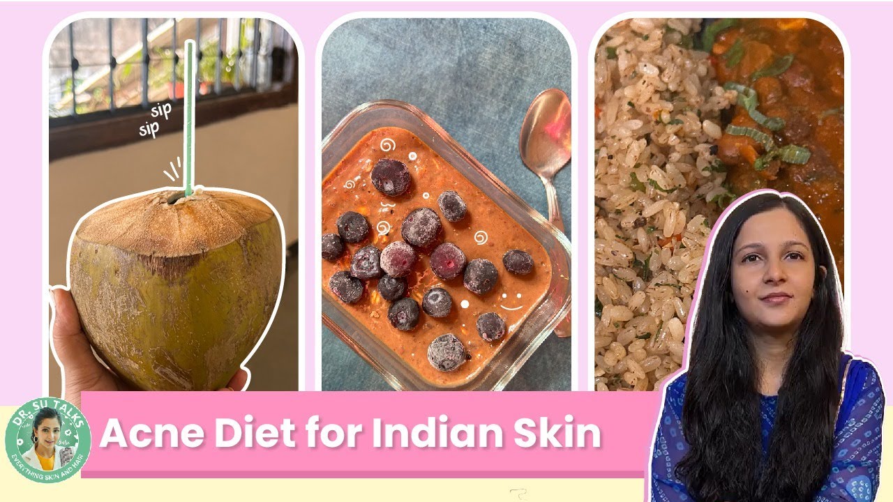 Best acne diet for Indian skin | What to eat & avoid for clear skin ...