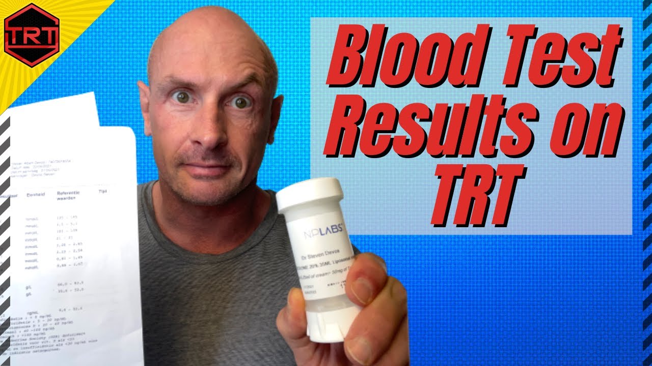 My Blood Test Results On TRT YouTube my-blood-test-results-on-trt-youtube