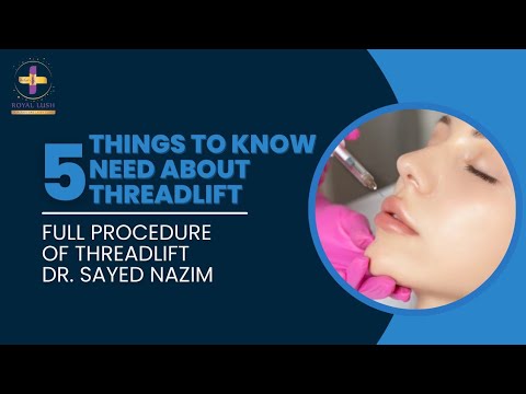 Thread Lift Surgery | Non Surgical Facelift | Full Procedure by Dr.Syed ...