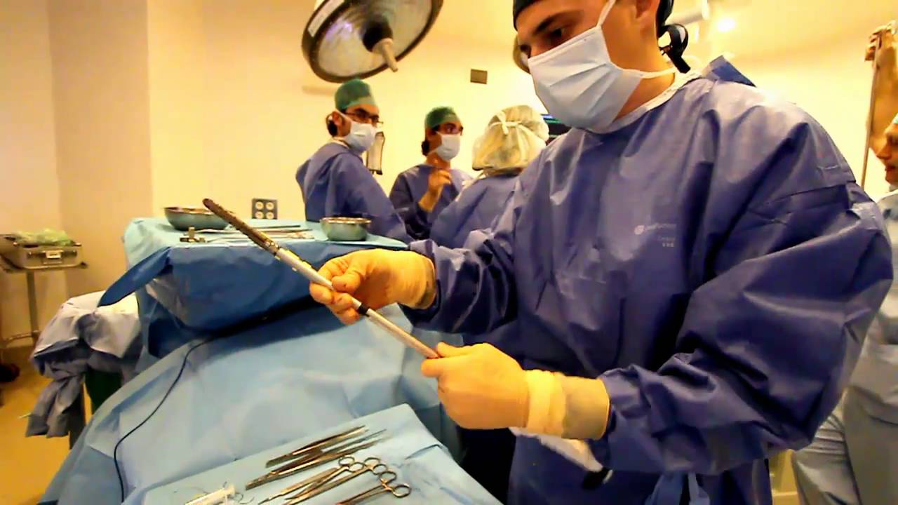 Lobectomia VATS single port en cancer de pulmon - YouTube