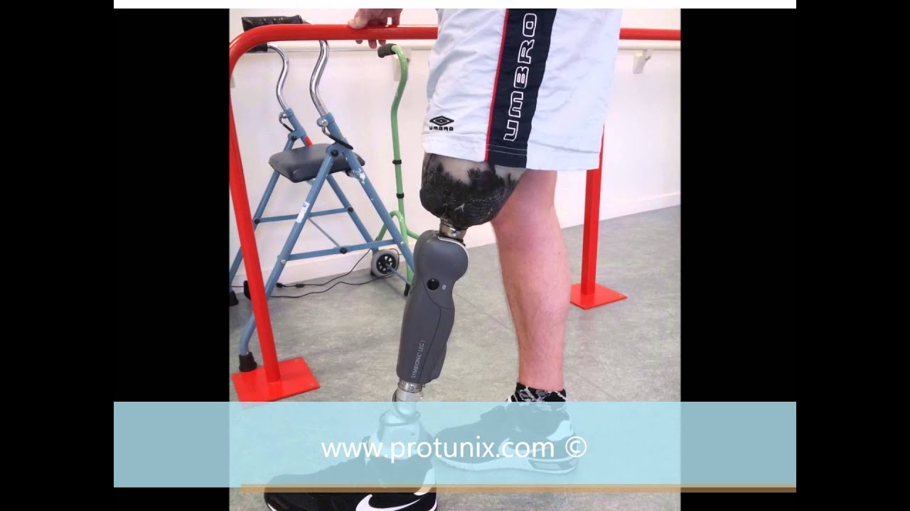 Prothèse fémorale équipée d'un Symbionic leg - YouTube