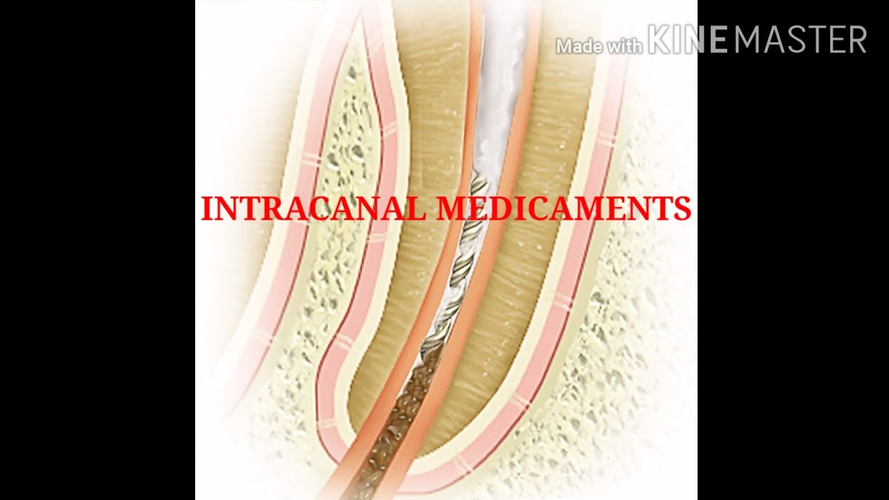 INTRACANAL MEDICAMENTS | various types| for BDS students exam point of ...