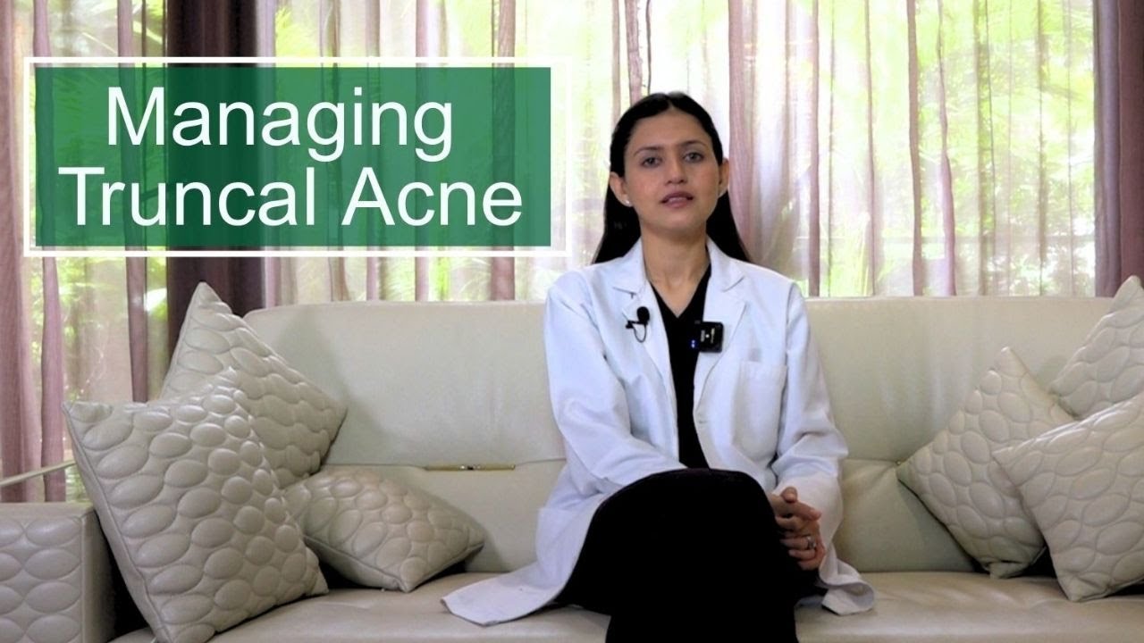 Truncal Acne Explained: Causes and Management by Dermatologist Dr ...