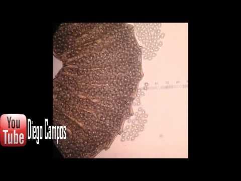 Hymenolepis nana - Adulta / gravida / Cuerpo pseudo estratificado