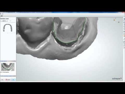 3Shape's new Model Builder™ - YouTube