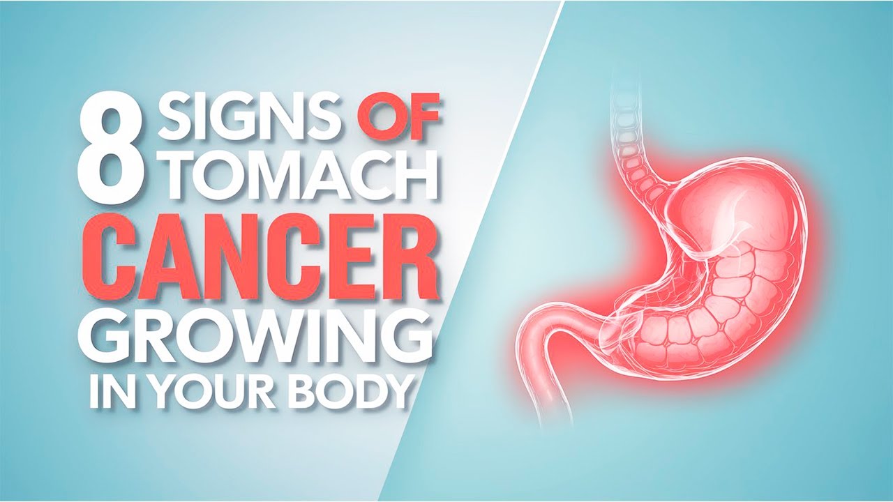 8 Stomach Cancer Red Flags Your Doctor Won't Tell You About! - YouTube