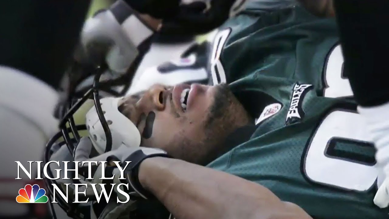 Brain Disease In 110 Out Of 111 NFL Players’ Brains, Study Finds | NBC ...
