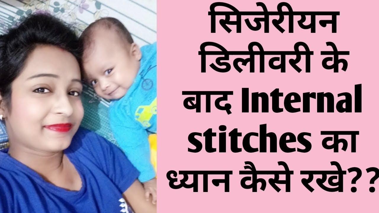 सिजेरियन डिलीवरी के बाद Internal stitches की केयर कैसे करे? after ...