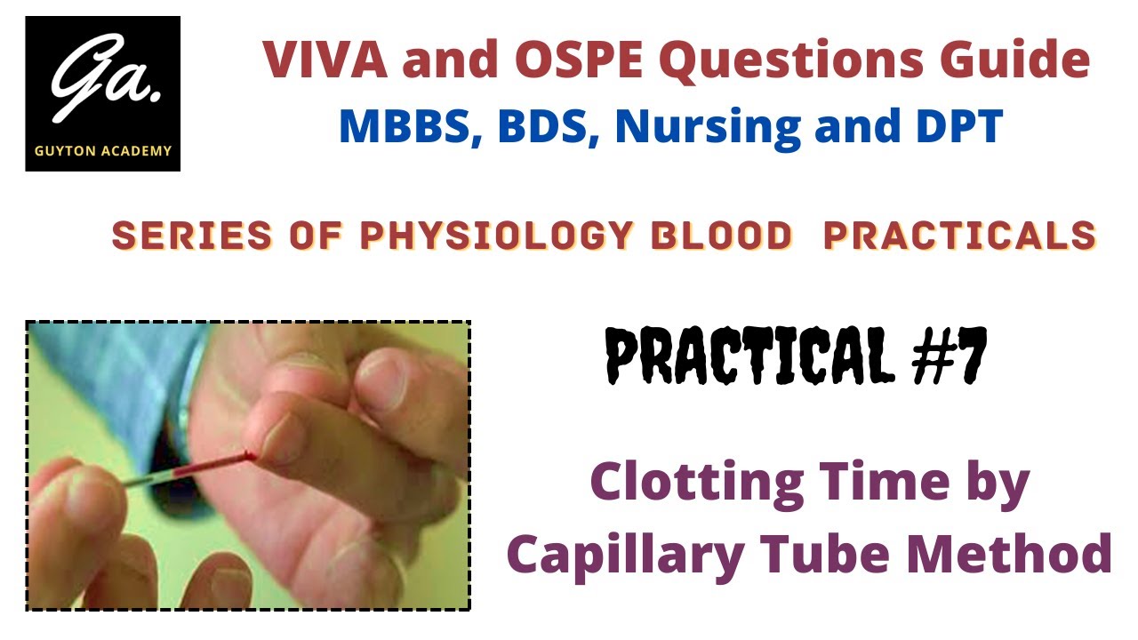 Experiment 7 – Clotting Time | VIVA and OSPE Questions Guide ...