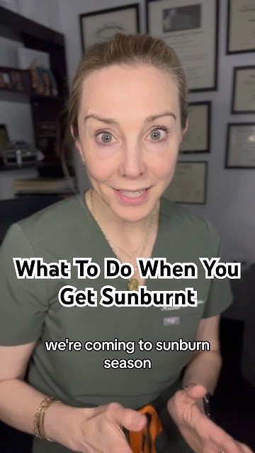 Heres What I Think You Should Do If You Get Sunburnt This Summer