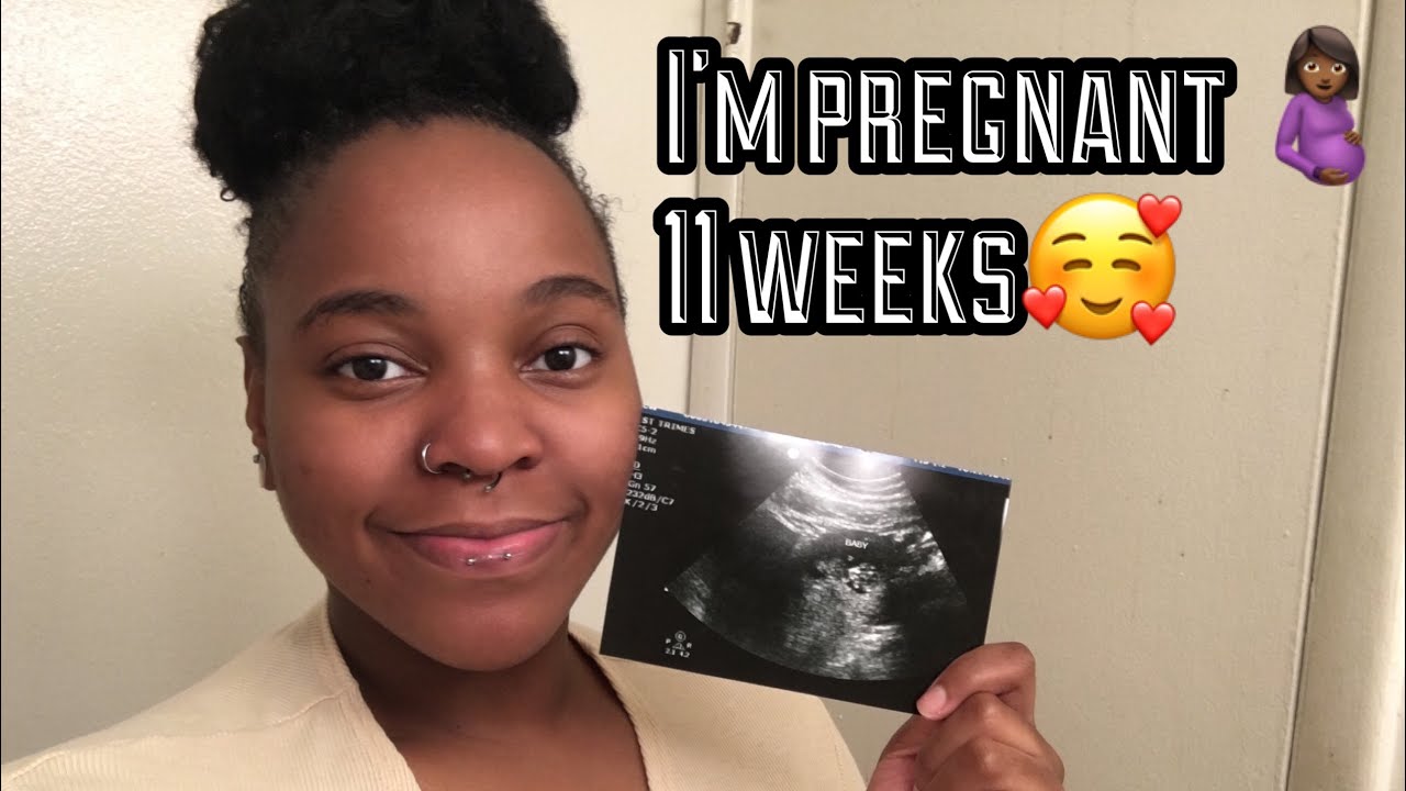 I’m PREGNANT 11 weeks Update 🤰🏾 - YouTube