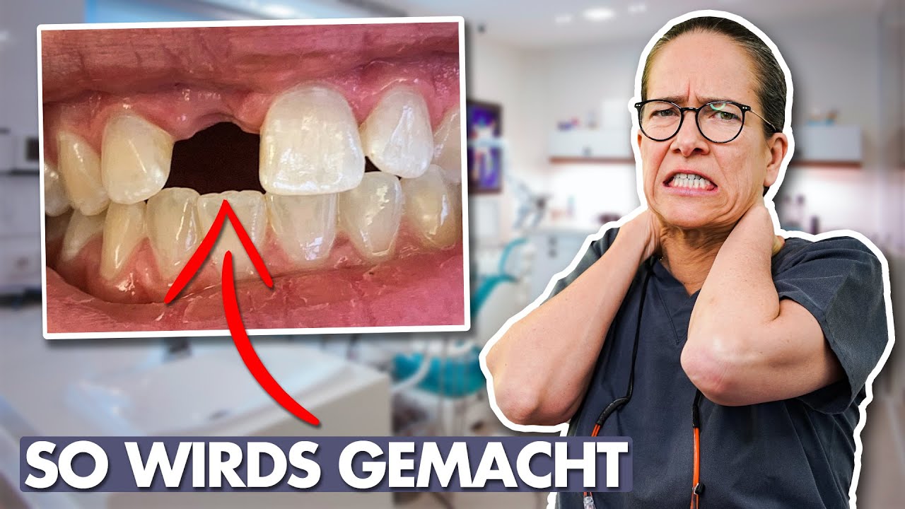 Zähne ziehen: DAS erwartet dich als Patient - YouTube