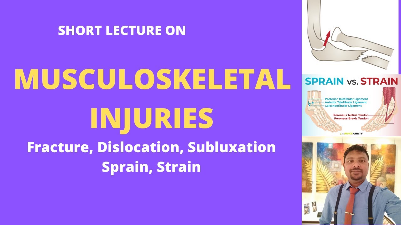 MUSCULOSKELETAL INJURIES (FRACTURE, DISLOCATION, SUBLUXATION, SPRAIN ...