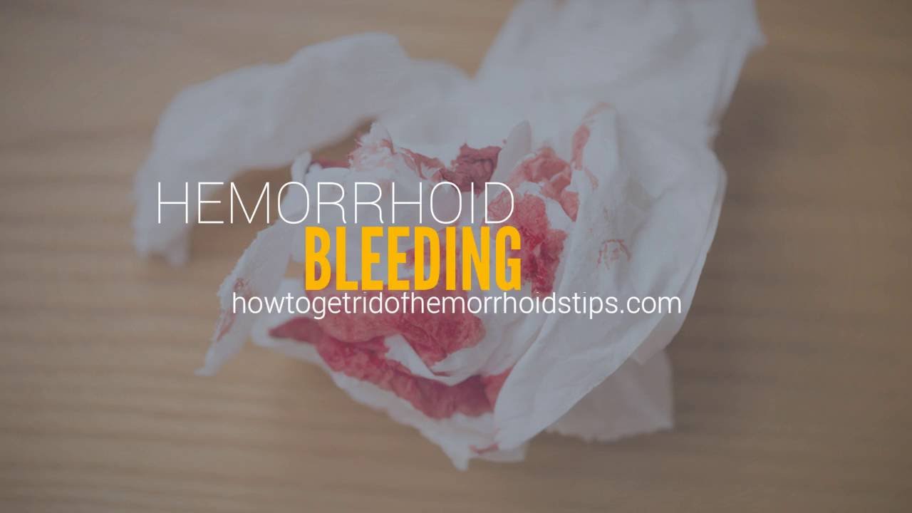 Hemorrhoid bleeding - YouTube
