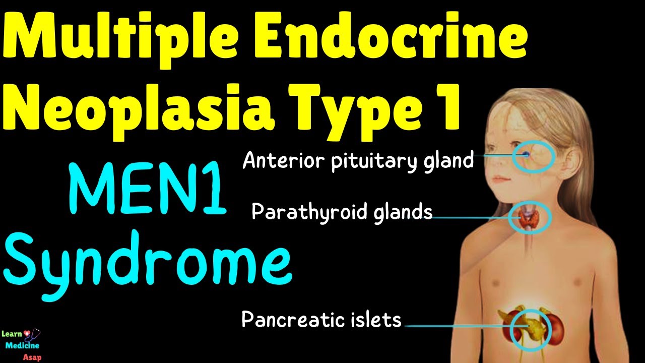 Multiple Endocrine Neoplasia Type 1 (MEN1 Syndrome) – Causes, Symptoms ...