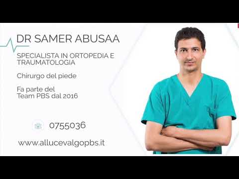 Dott. Samer Abusaa , chirurgia percutanea alluce valgo PBS