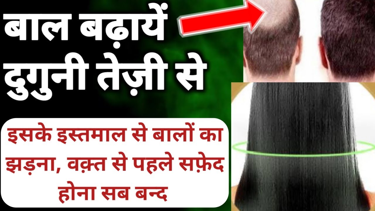 hairfall ke liye | balo ke jhadne ko rokne ke upay | balo ko safed hone ...