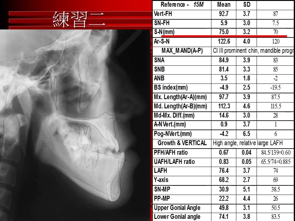 [Ortho] Ceph Tracing and Analysis - YouTube