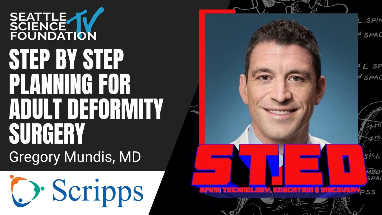 Step by Step Planning for Adult Spinal Deformity Surgery – Greg Mundis ...