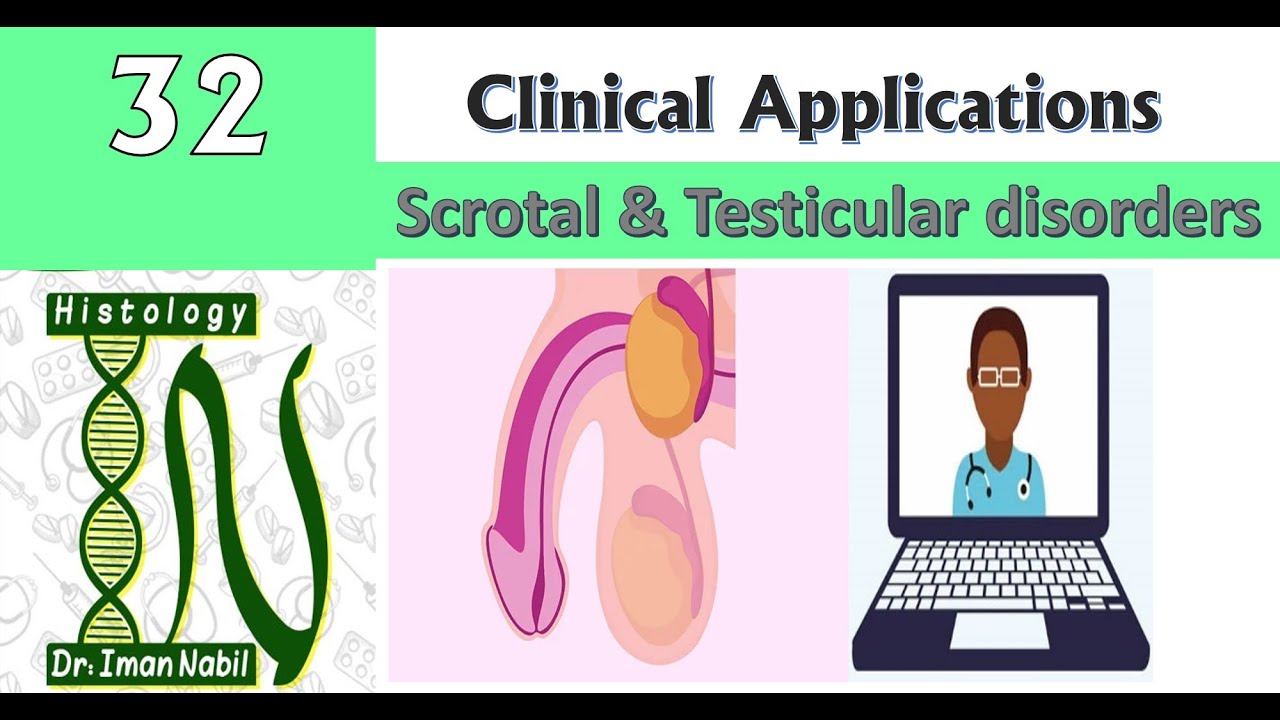32-Scrotal and testicular disordersإضطرابات كيس الصفن و الخصية-Clinical ...