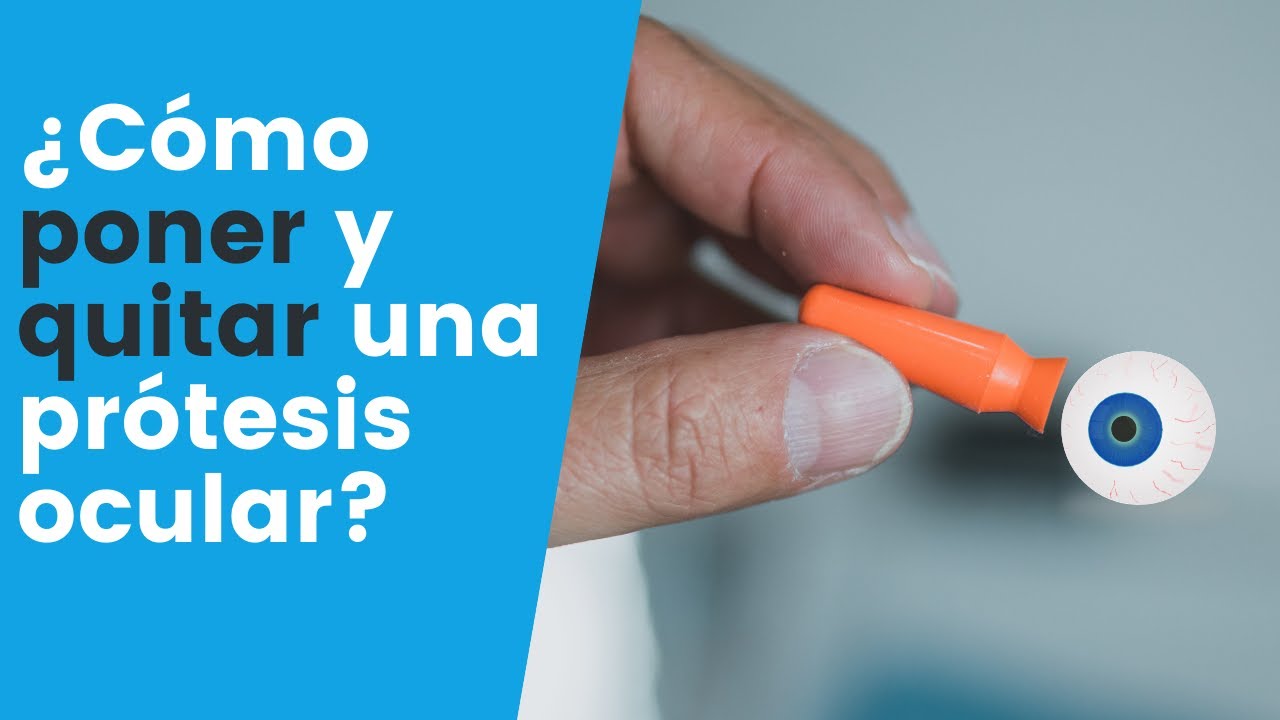 Colocación y remoción de Prótesis oculares- Dr Hector Gonzalez Colombia ...
