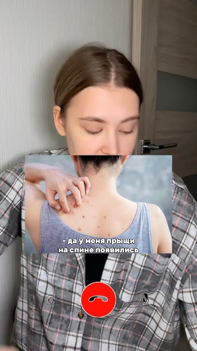 Как убрать прыщи на спине? Гель для душа: 246443845, сыворотка ...