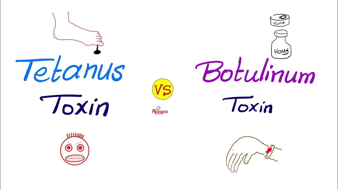 tetanus-toxin-vs-botulinum-toxin-comparisons-series-youtube