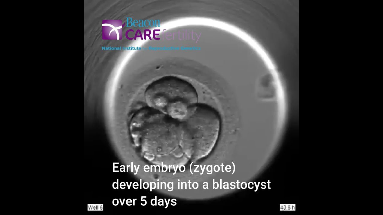 Early embryo (zygote) to blastocyst-Time lapse imaging-Beacon CARE ...