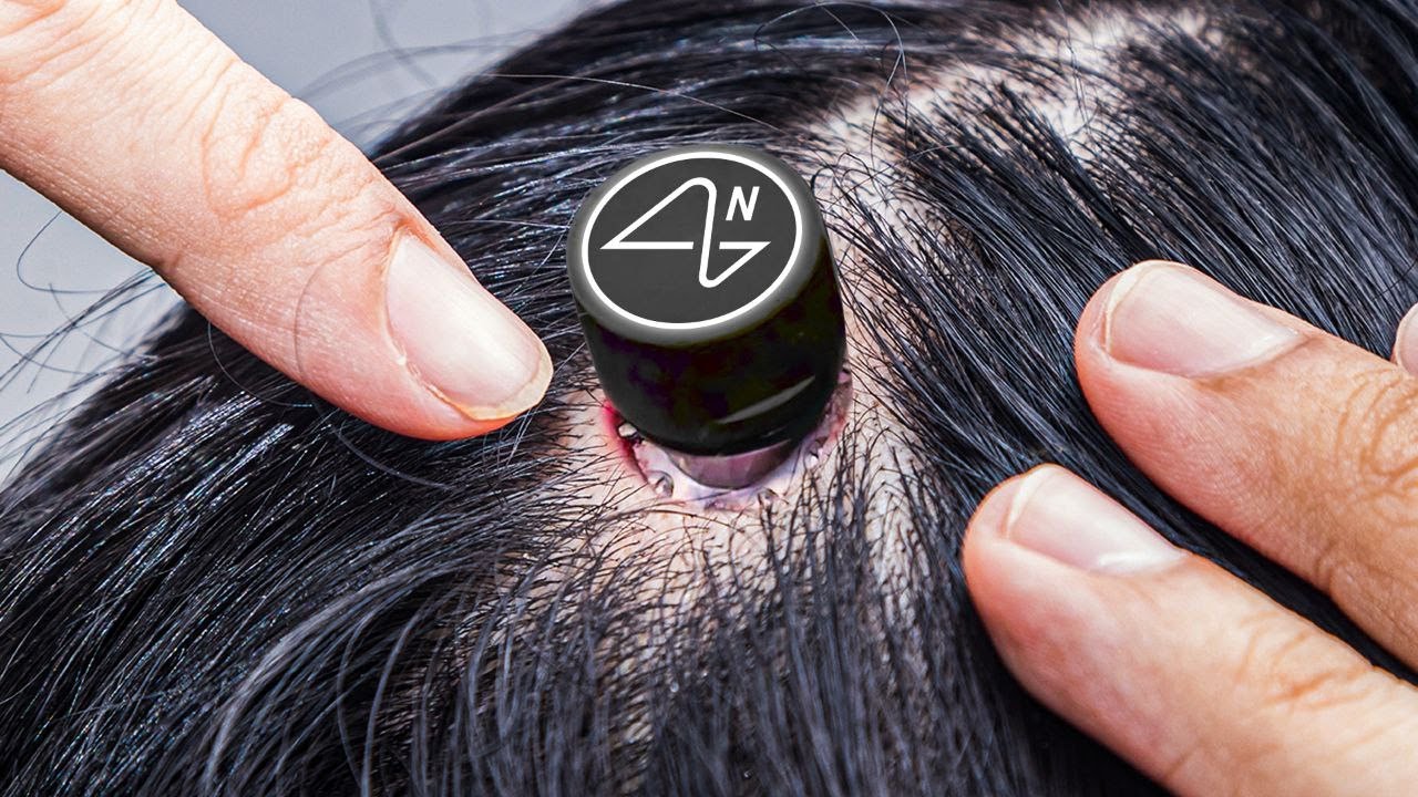 Brain Chip: First Human Cyborg - YouTube