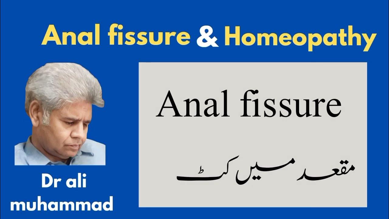 Anal Fissure Treatment In Homeopathy Dr Ali Muhammad Youtube