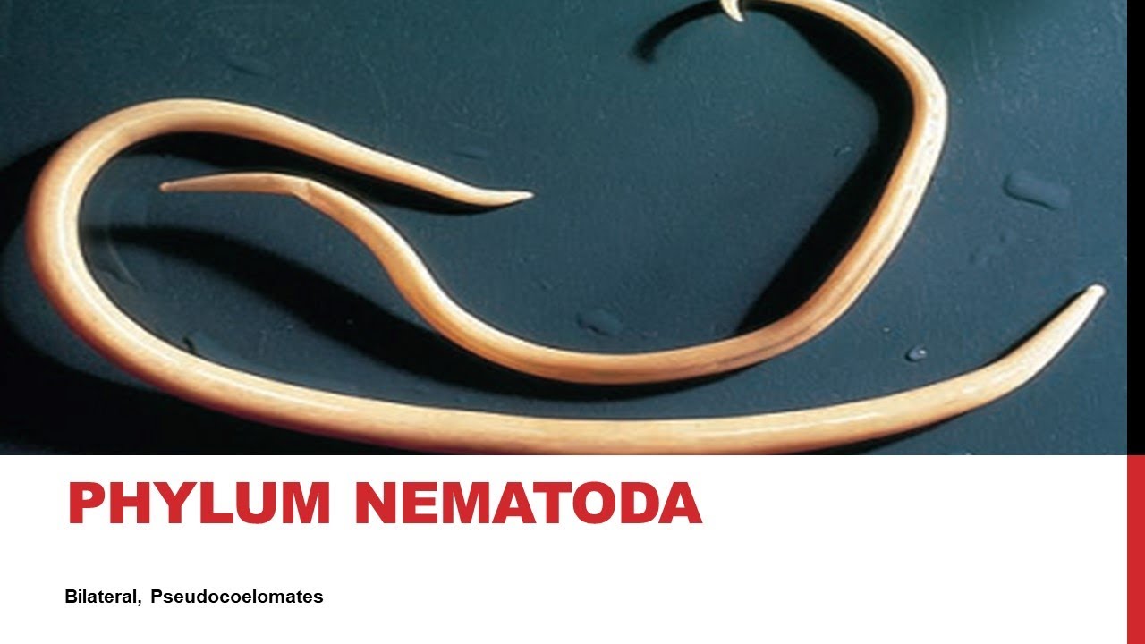 Phylum Nematoda Hookworm