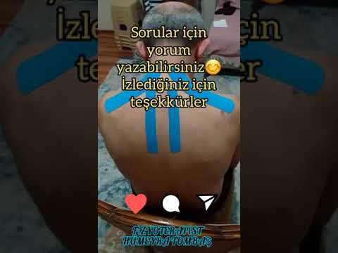 Boyun ve Omuz Bölgelerinde Kinezyobant Uygulaması