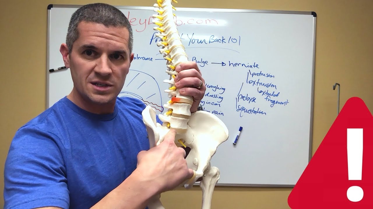 Chiropractor Describes Low Back Disc Problems - How to understand the ...