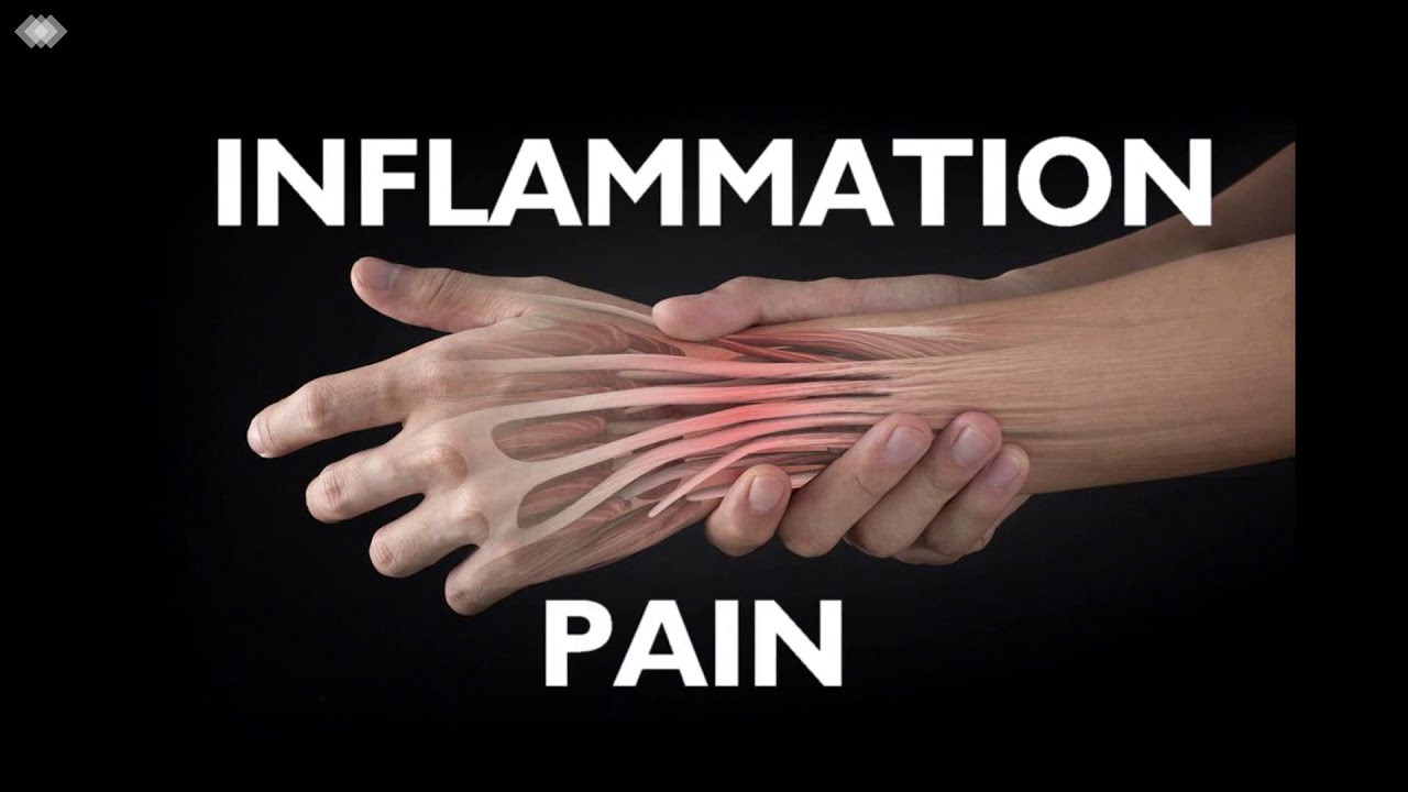 MYOGLOVE - TENDONS CARE FOR MUSICIANS - STOP GUITAR PAIN - YouTube
