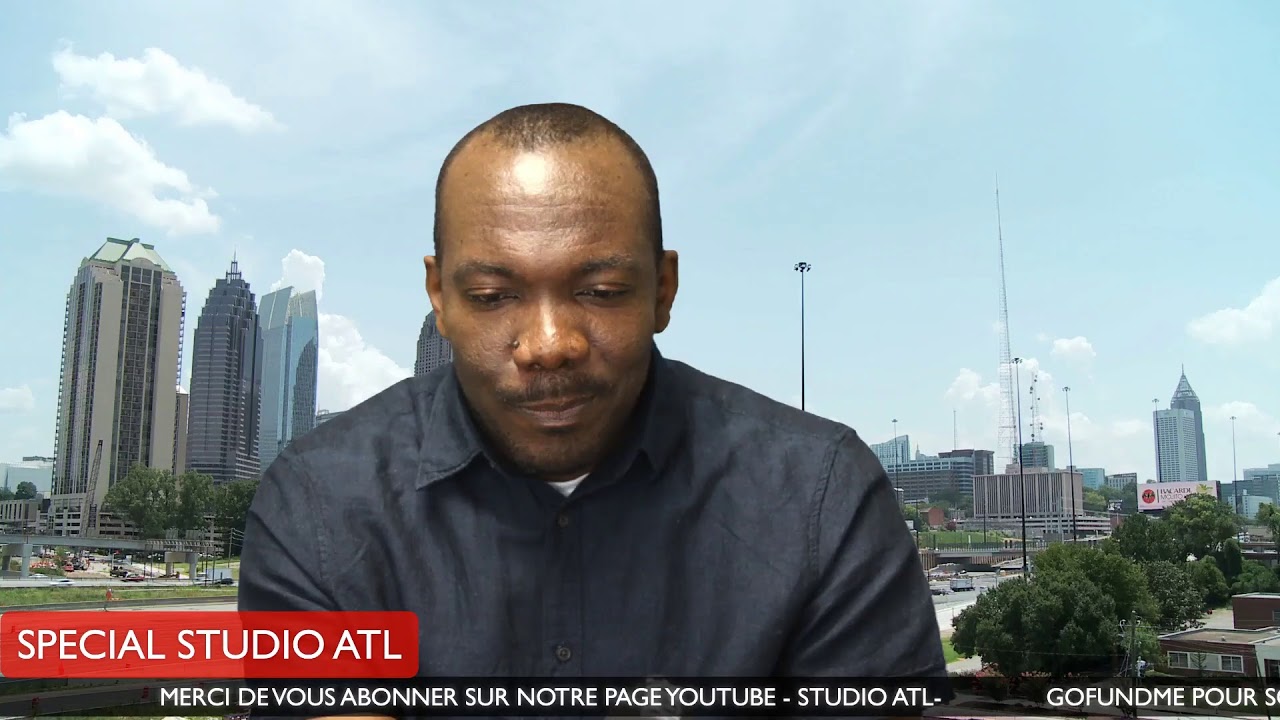 FM LIVE Dr Patrick Mwamba, le Numero 1 mondial des greffes de cheveux ...